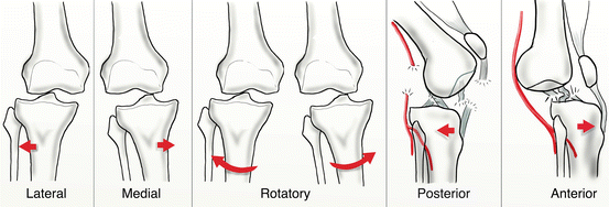 Orthopedics — Blog — NUEM Blog