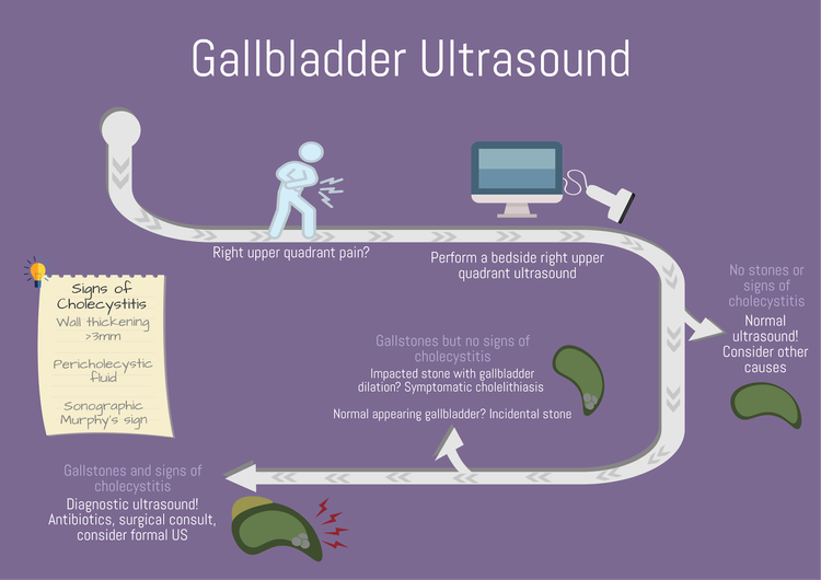 SonoPro Tips and Tricks for Acute Cholecystitis — NUEM Blog
