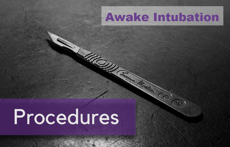 Awake Intubation — NUEM Blog