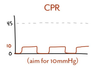 Basic Capnography Interpretation — NUEM Blog