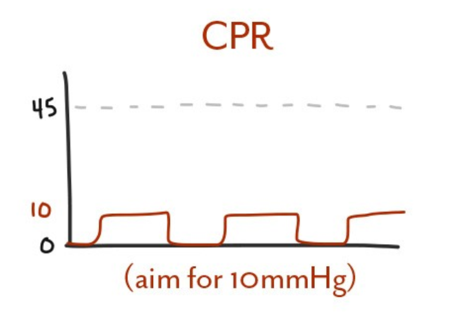 Basic Capnography Interpretation — NUEM Blog