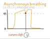 Basic Capnography Interpretation — NUEM Blog
