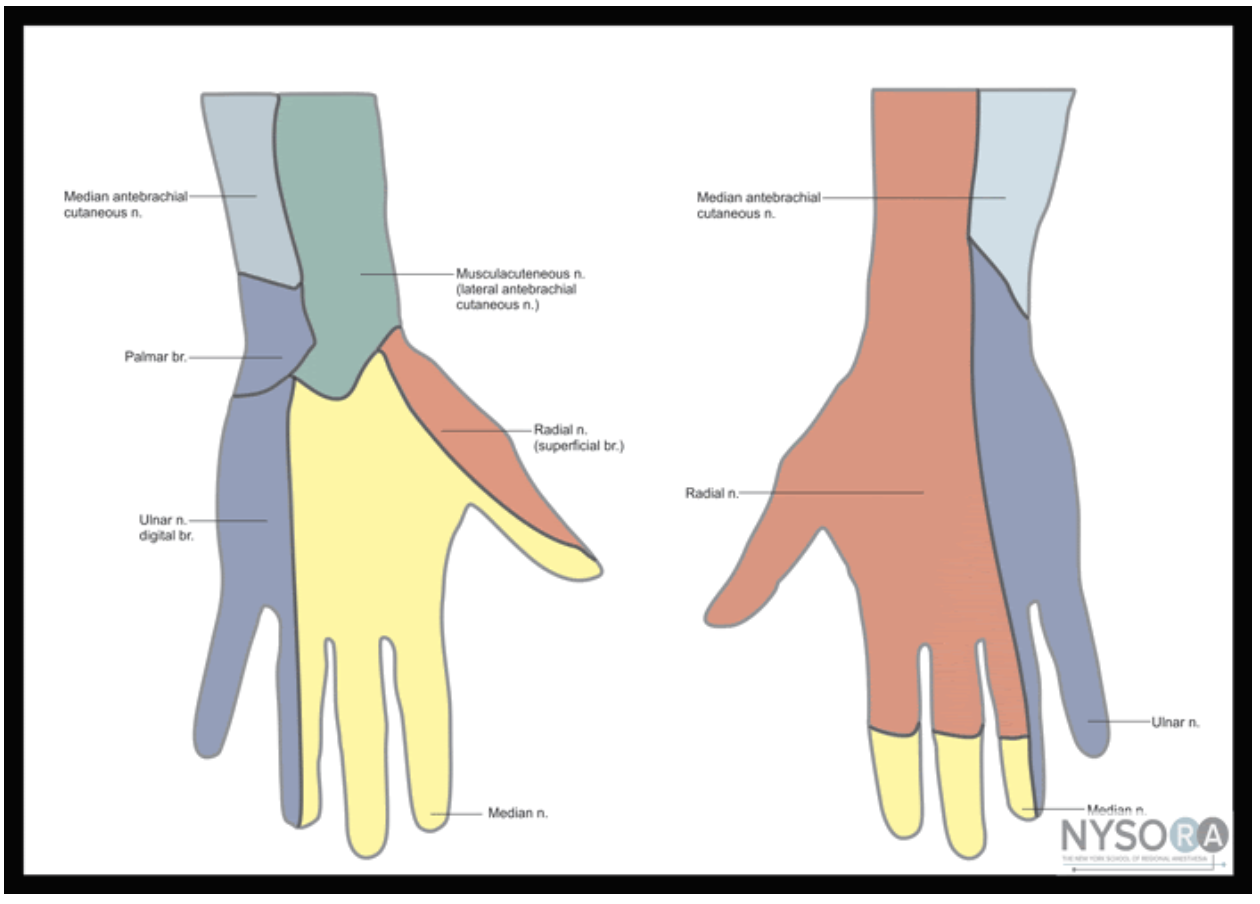 Hand Nerve Blocks — NUEM Blog