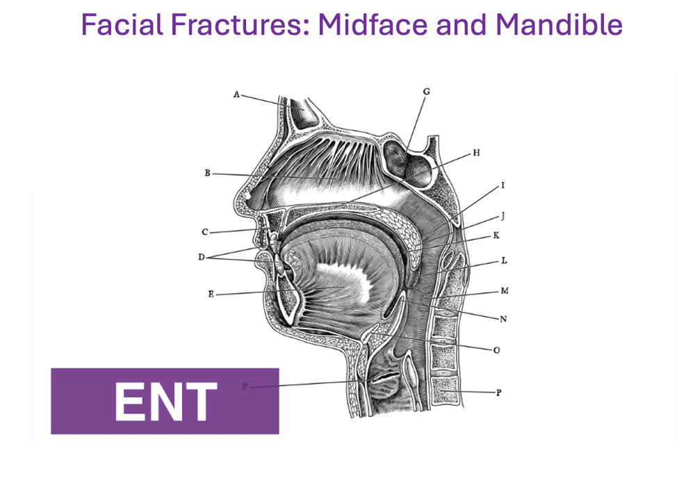 Facial Fractures: Midface and Mandible — NUEM Blog