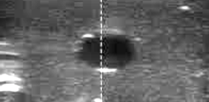 SonoPro Tips and Tricks for Peripheral IV Access — NUEM Blog