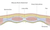 DIÁSTASIS ABDOMINAL | Instituto Madrileño de Diástasis Abdominal