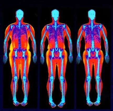 DEXA Scan for Body Fat, Visceral Fat, Bone Density | DEXA Scan Near Me