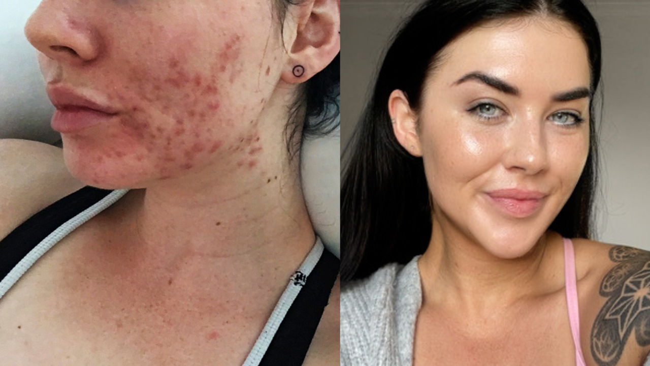 11 Glowing Skin Hacks: Get the BEST Skin of Your Life — EAT RUN LIFT