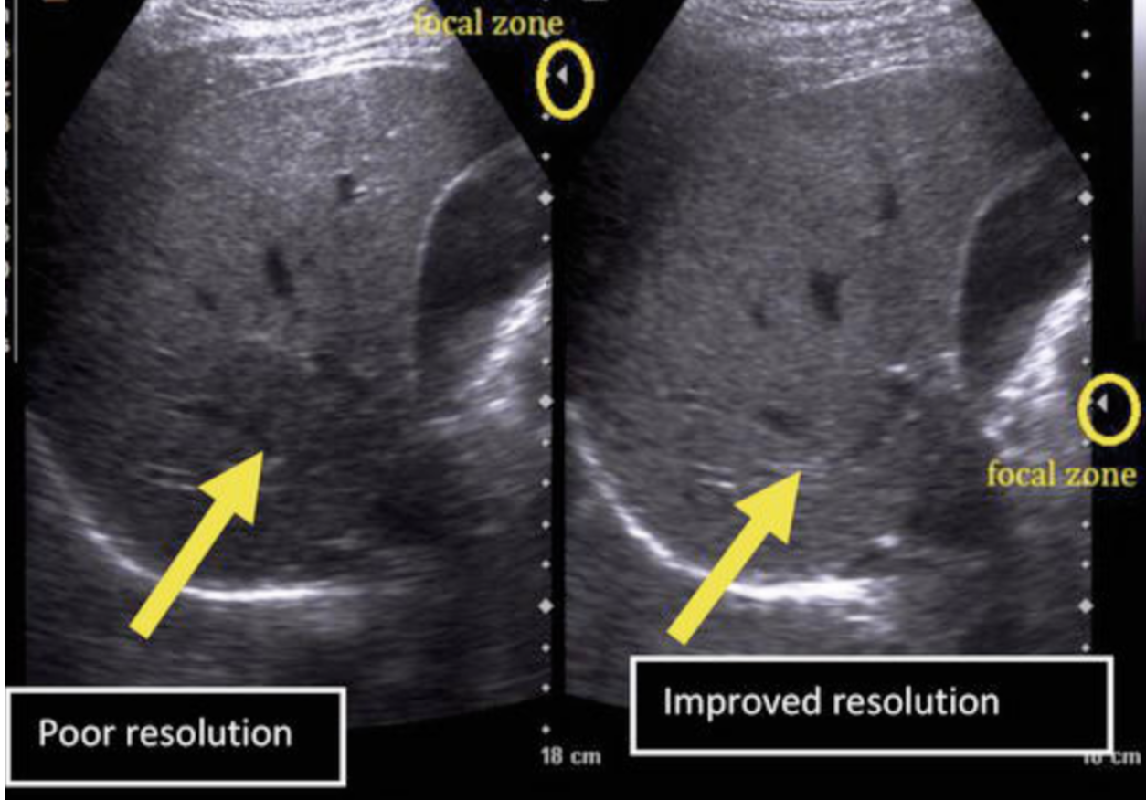 KNOBOLOGY & IMAGE OPTIMISATION — MMHEME