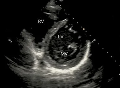 ECHO & FELS — MMHEME