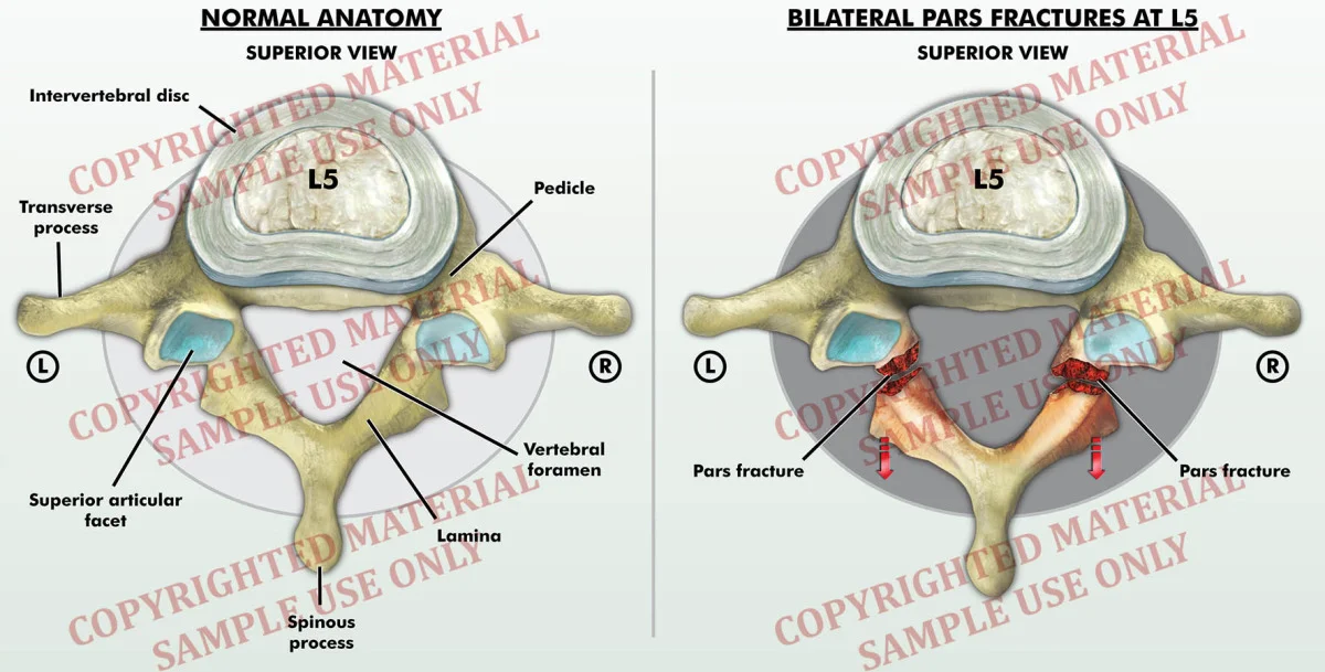 Jeremy N. Brotherton B.A., M.S.