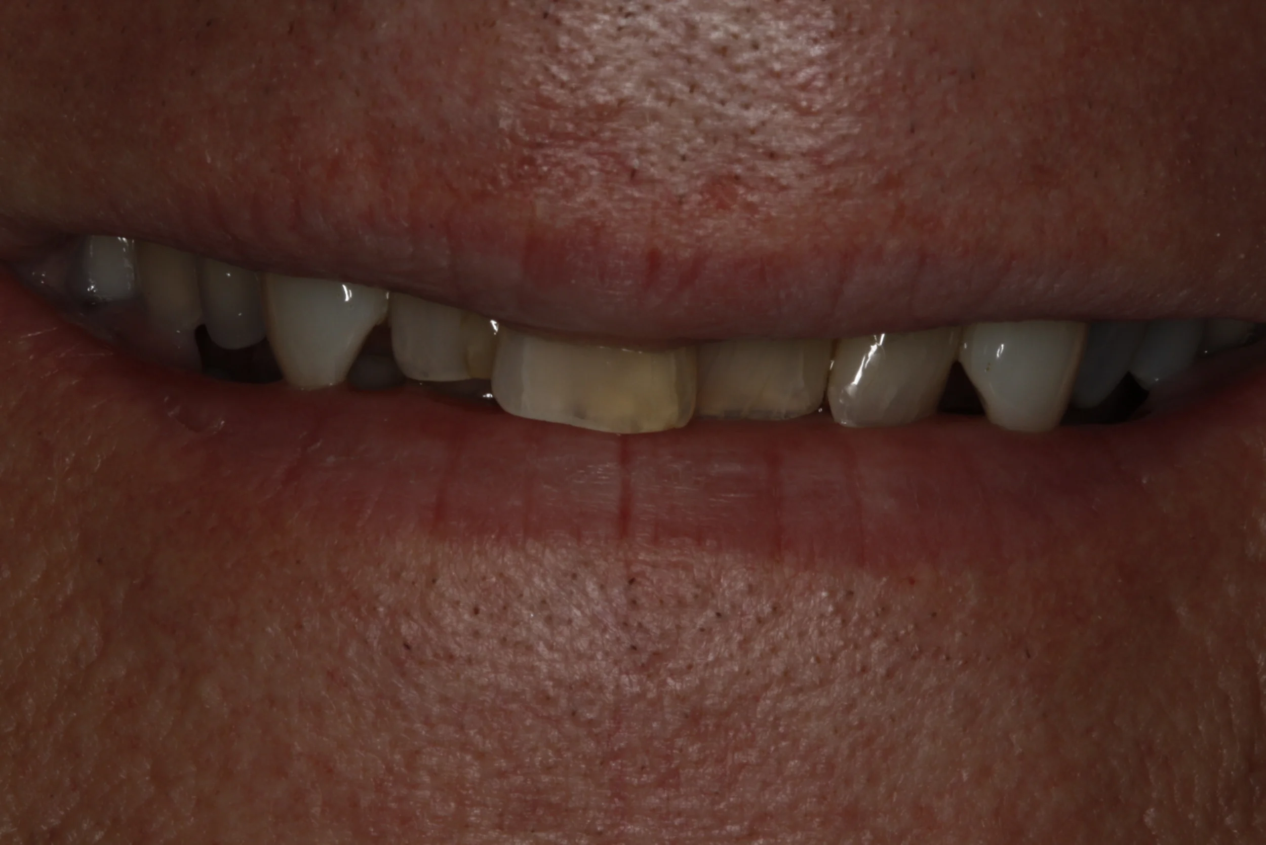 Amber — Lisa L. Buttaro DDS