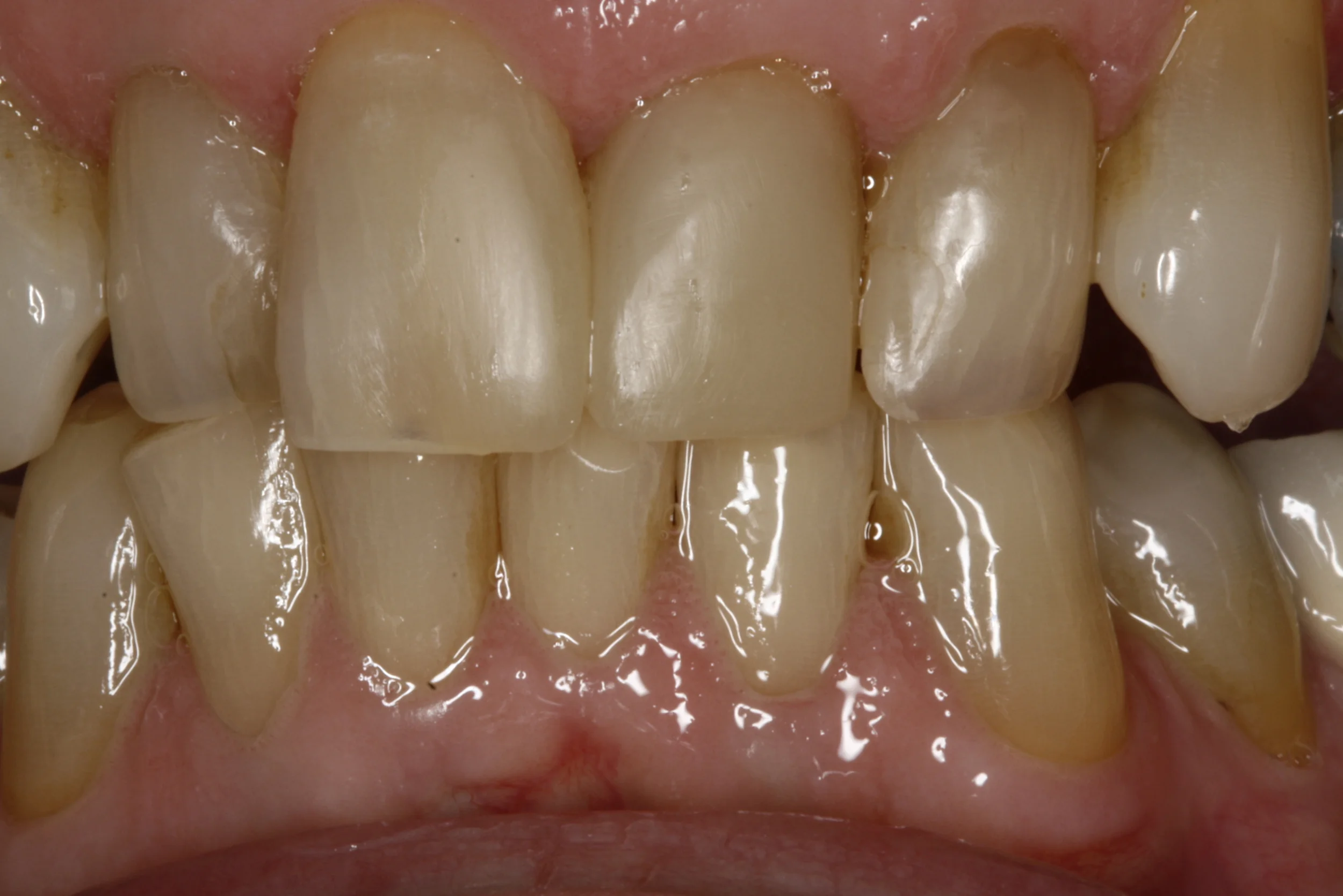 Amber — Lisa L. Buttaro DDS