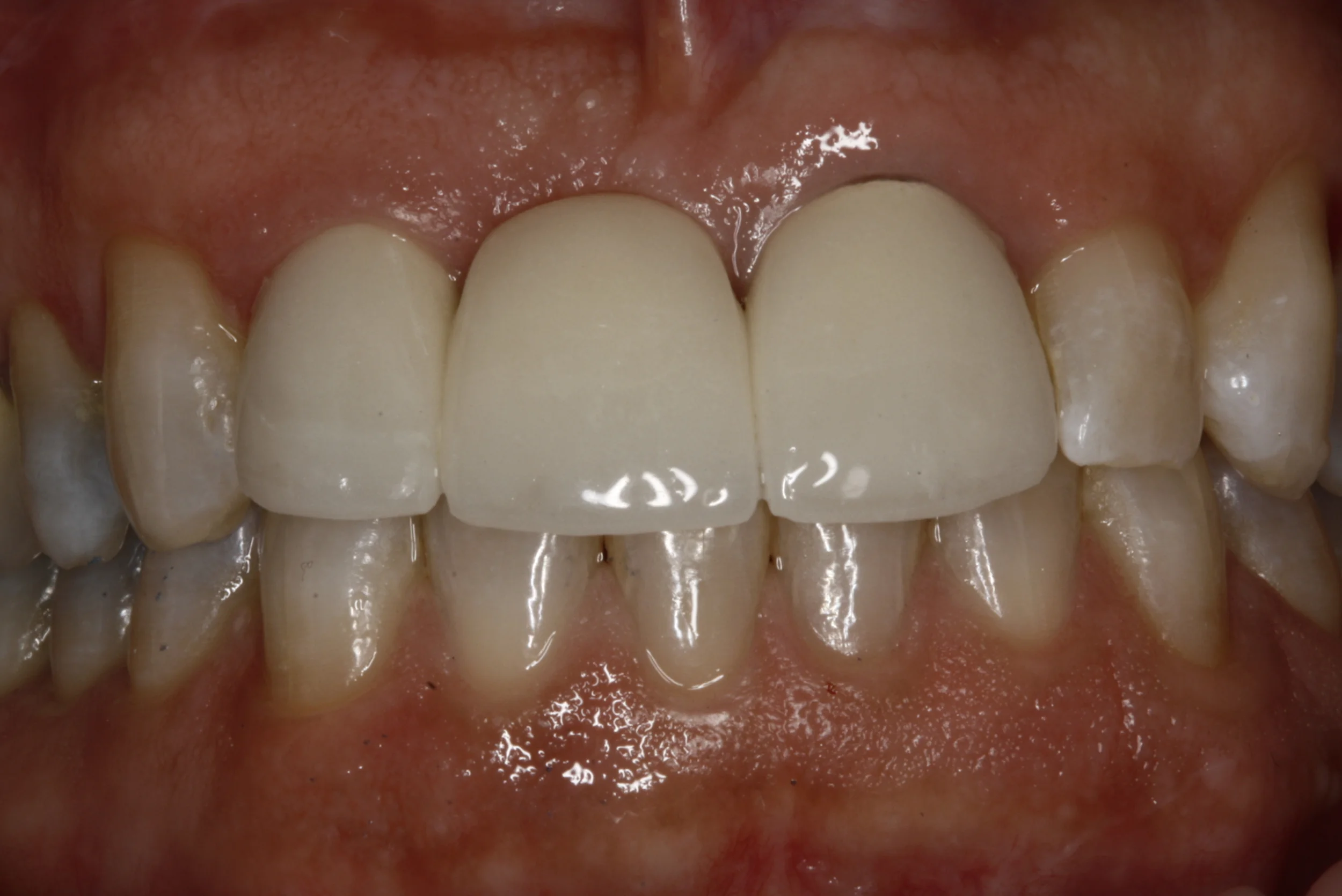 Amber — Lisa L. Buttaro DDS