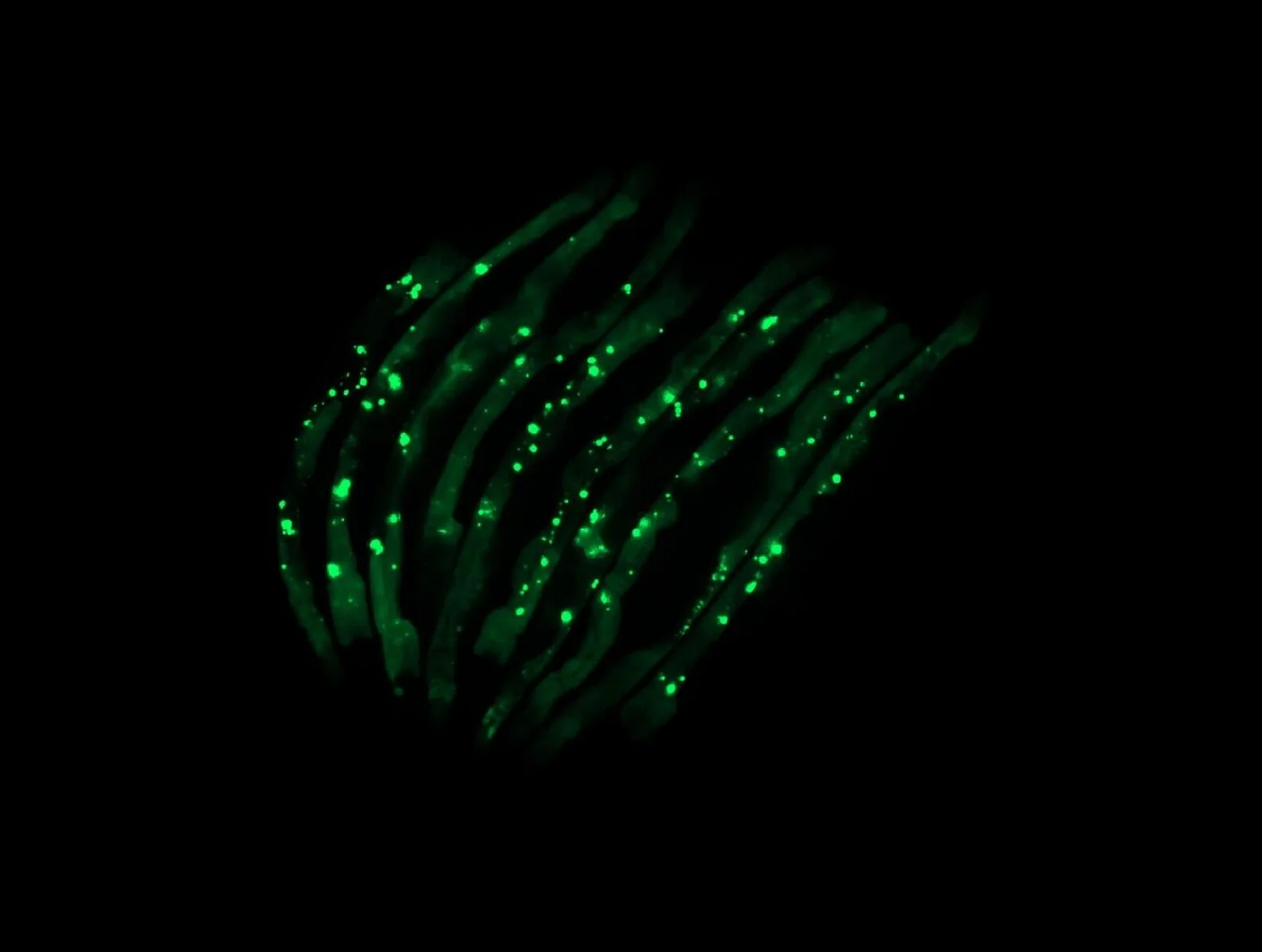How a microscopic worm can help us in the fight against Alzheimer's disease