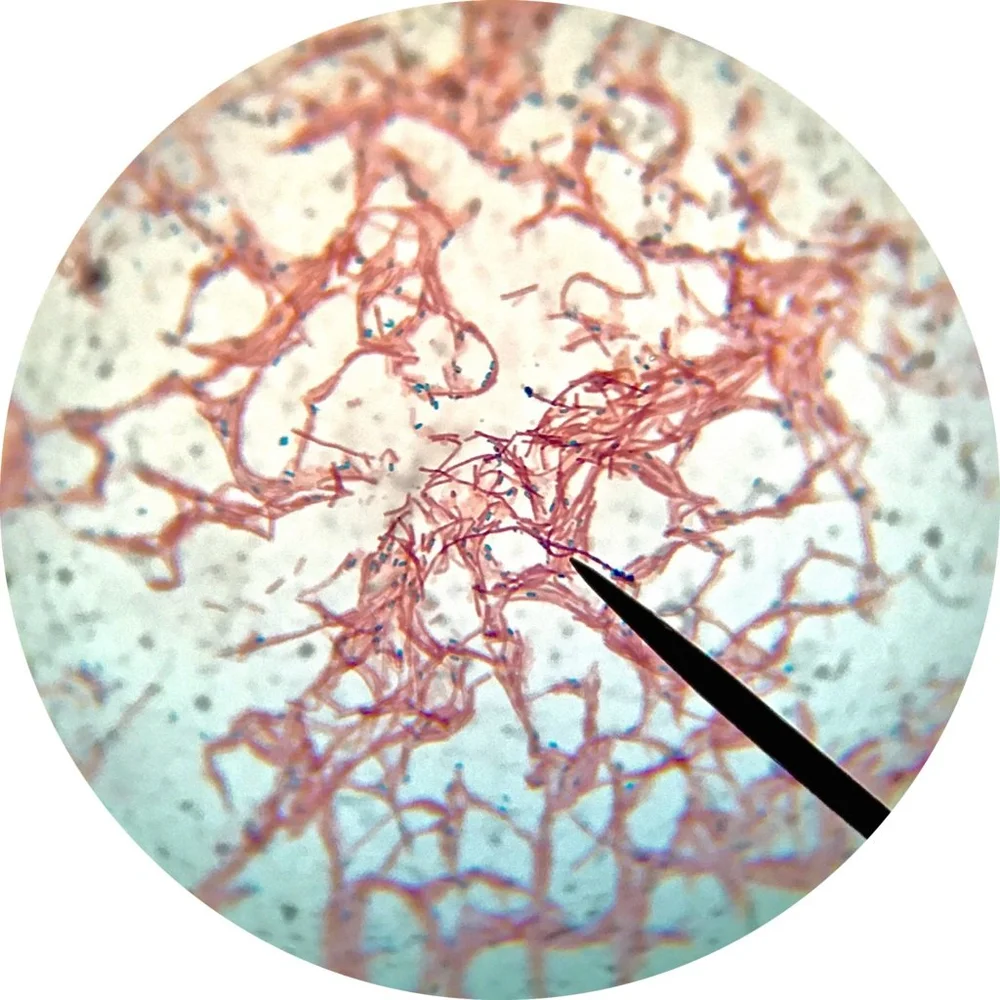 Unraveling a 150 Year Old Mystery: How Dormant Bacteria Spring Back to Life