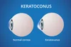Amazing: bioengineered cornea restores vision for people suffering from ...