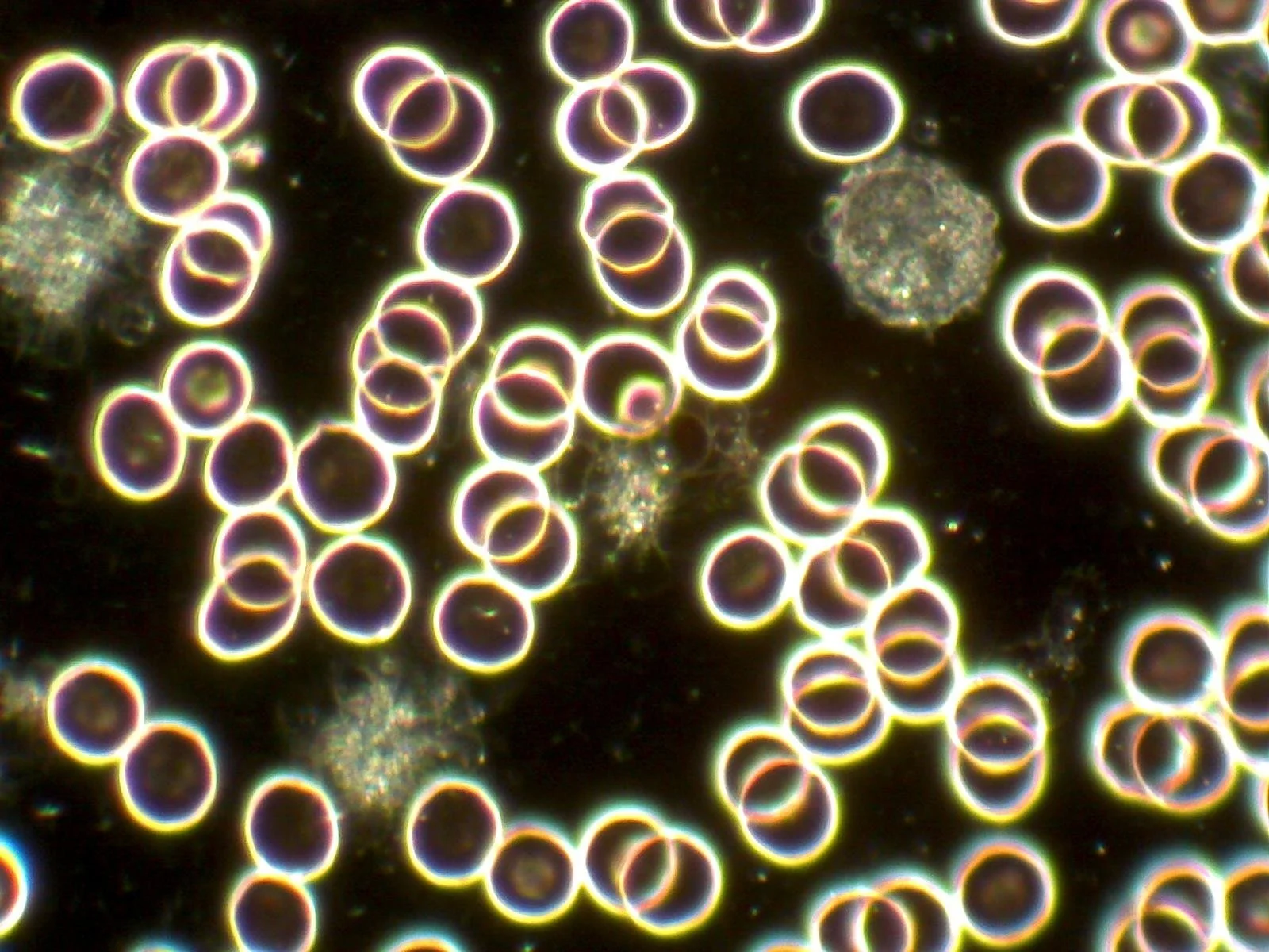 Live & Dry Blood Analysis — Vitalise Nutrition