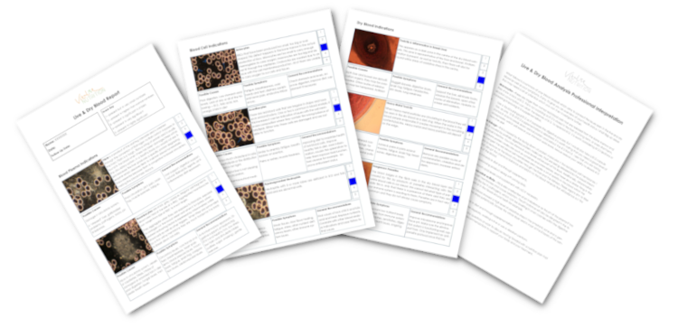 Live & Dry Blood analysis — Vitalise Nutrition