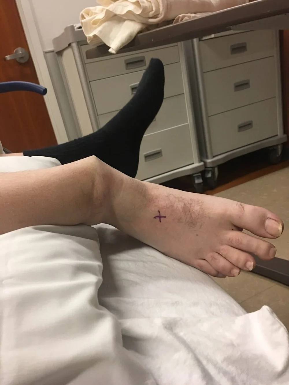 Fractures - General principles, ankle, femur, pelvis — LAMRT Members' Site