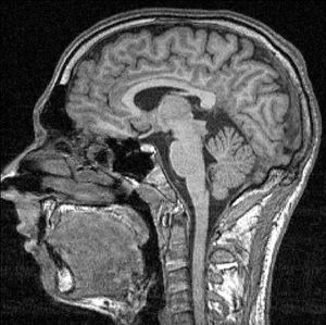 Researchers Question Value of Brain Imaging — Pain News Network