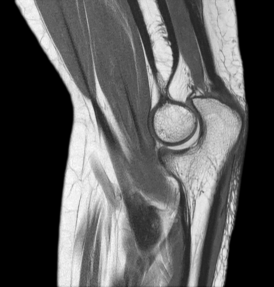 MRI — Hutchinson Clinic