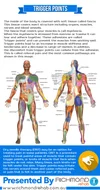 Trigger Points Explained — Richmond Rehab | Physio, Exercise & Massage