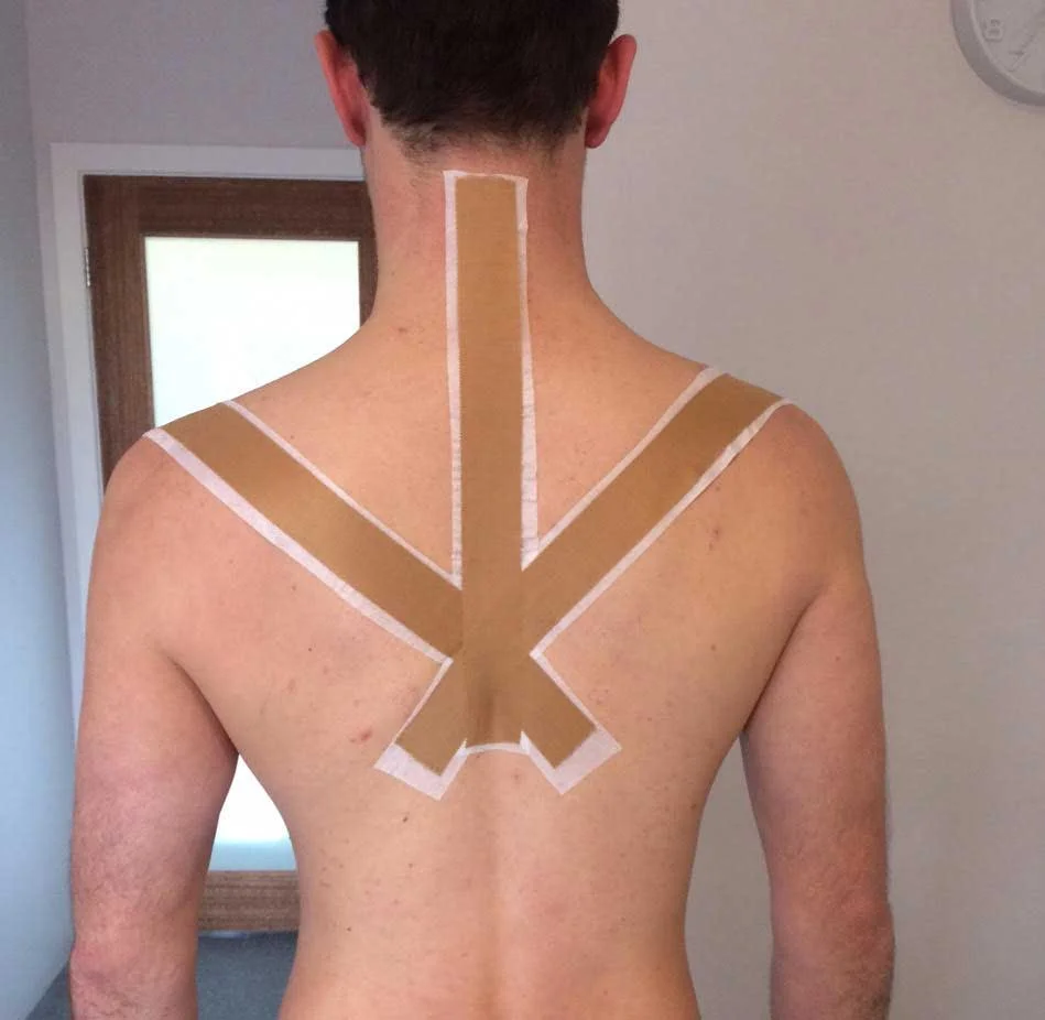 Taping for Postural Correction — Richmond Rehab - Physiotherapy ...