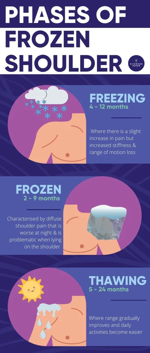 Frozen Shoulder (Adhesive Capsulitis) — Richmond Rehab | Physio ...
