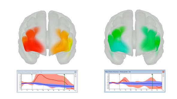 2fNIRS workshop: Hyperscanning with the OctaMon - Artinis Medical ...