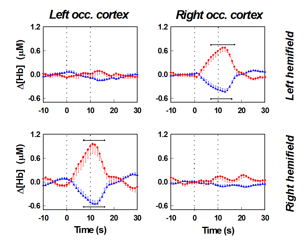 Artinis Medical Systems | fNIRS and NIRS devices-Near Infrared ...