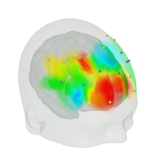 3D Digitization and Co-Registration to the MNI brain template using ...