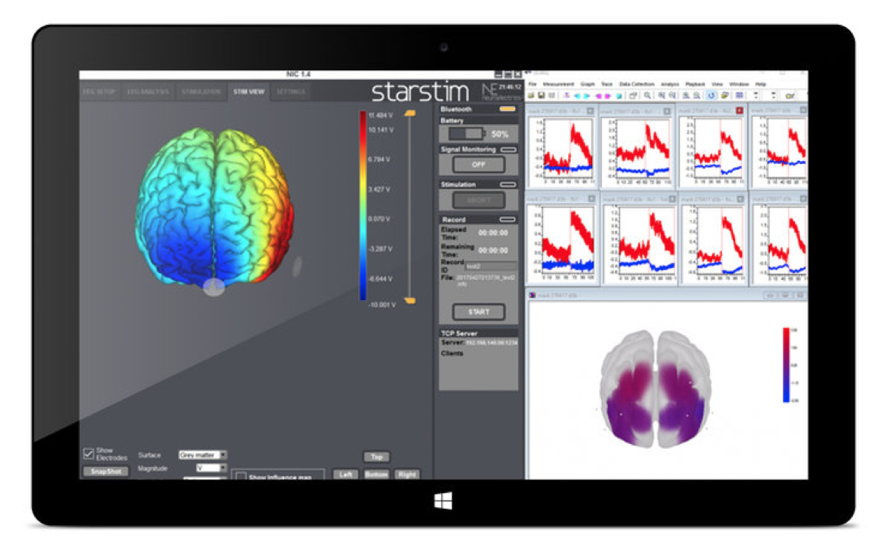 Combining the world of NIRS and EEG - Artinis Medical Systems | fNIRS ...