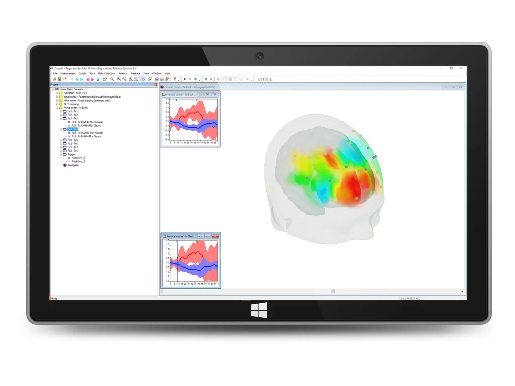 Brite Frontal - Artinis Medical Systems | fNIRS and NIRS devices