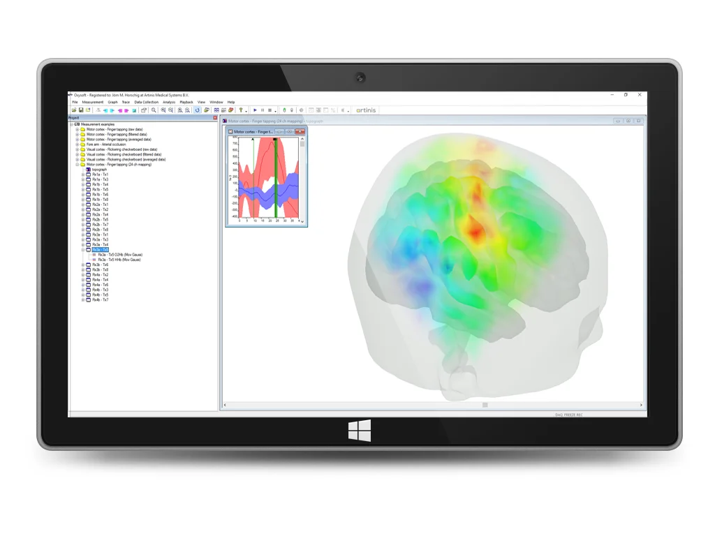 NIRS and fNIRS devices - Artinis Medical Systems | fNIRS and NIRS devices