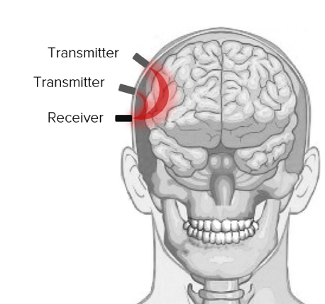 How NIRS is used in brain-computer interfaces - Artinis Medical Systems ...