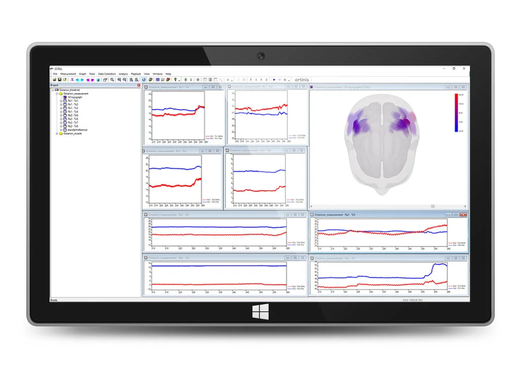 How to: Start a measurement and do a short analysis - Artinis Medical ...