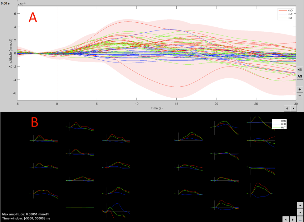 fNIRS analysis toolbox series – NIRSTORM - Artinis Medical Systems ...