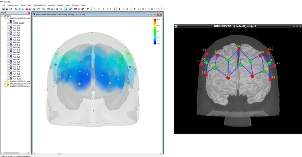 fNIRS analysis toolbox series – NIRSTORM - Artinis Medical Systems ...