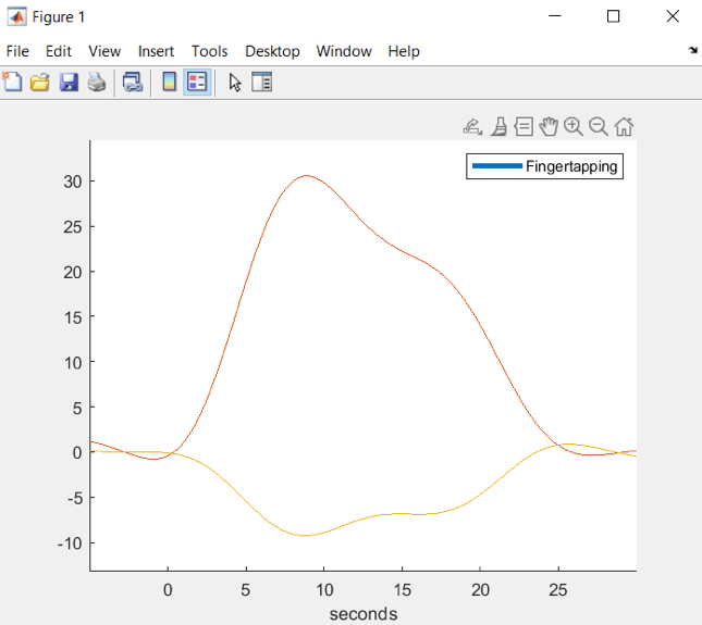 fNIRS analysis toolbox series – Brain AnalyzIR - Artinis Medical ...