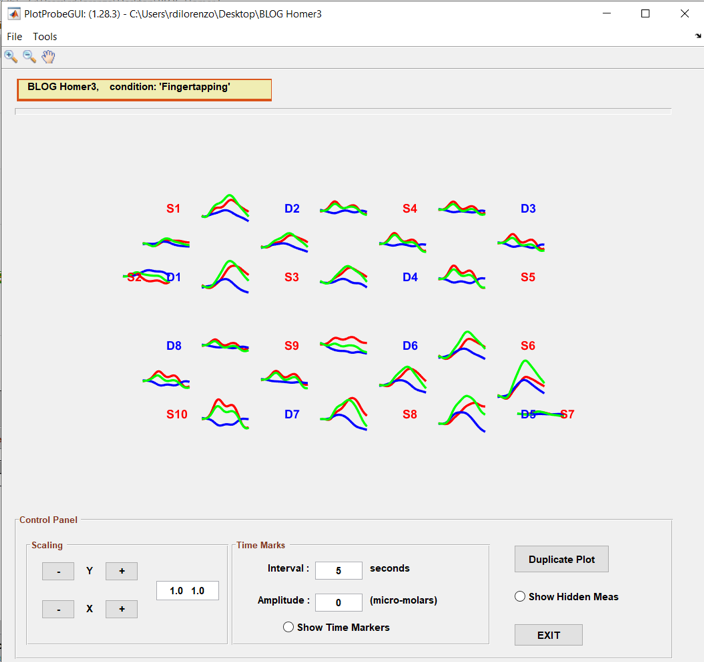 fNIRS analysis toolbox series – Homer - Artinis Medical Systems | fNIRS ...