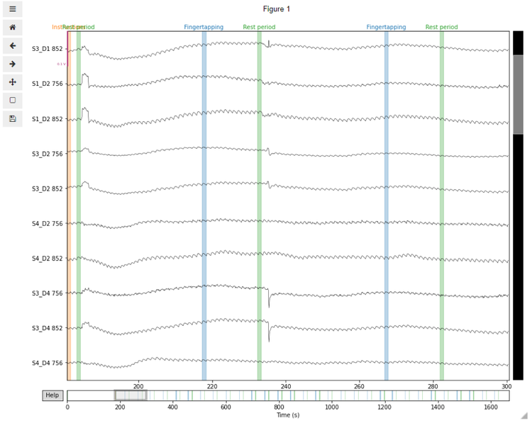 fNIRS analysis toolbox series – MNE/Python - Artinis Medical Systems ...