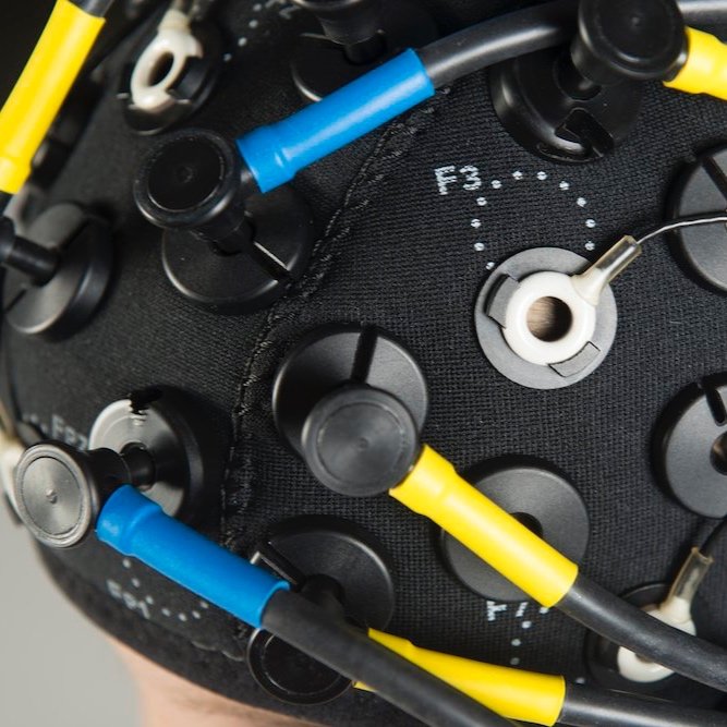 Introduction to multimodal fNIRS — EEG measurements - Artinis Medical ...