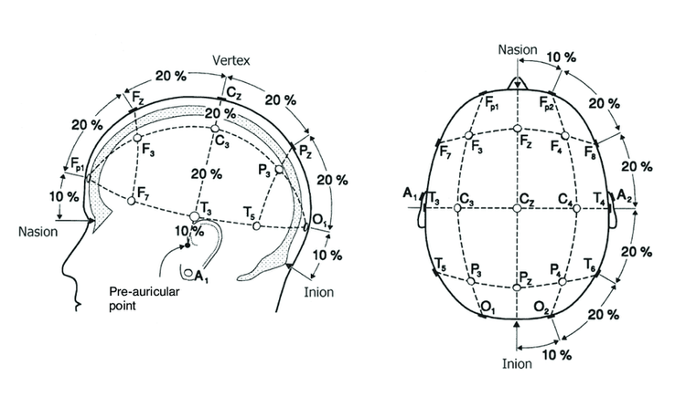 Multimodal fNIRS-EEG measurements — Integration on the head - Artinis ...