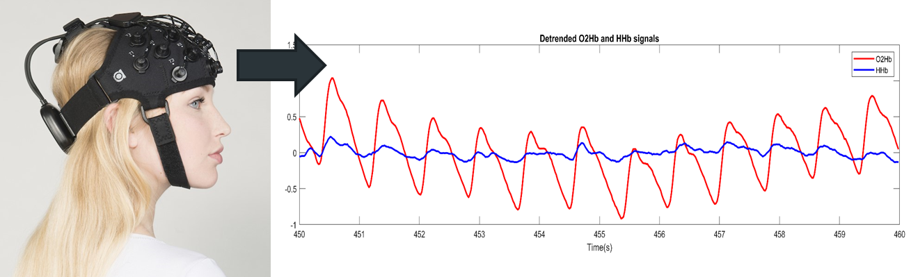 Assessing NIRS signal quality – Implementation of the Signal Quality ...