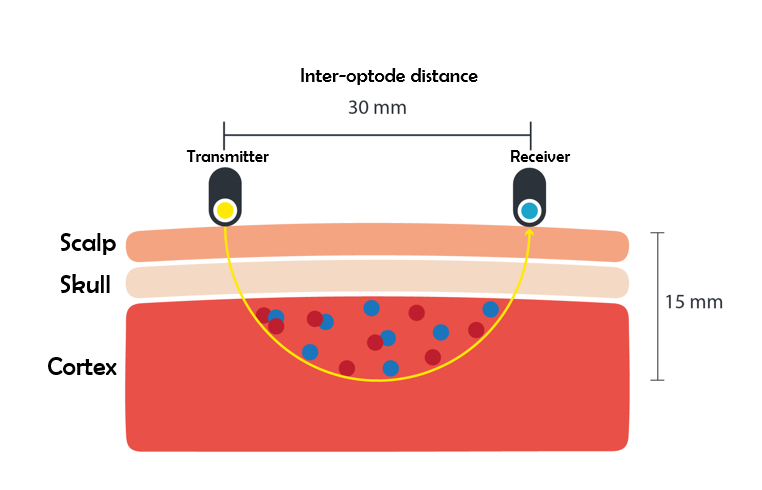 Multimodal fNIRS-EEG measurements — Integration on the head - Artinis ...