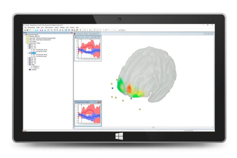 Brite Lite - Artinis Medical Systems | fNIRS and NIRS devices