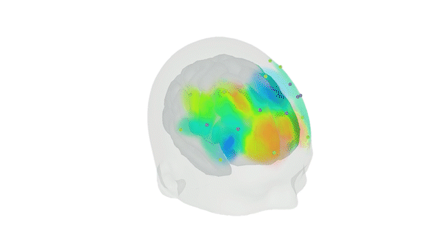 fNIRS — Prefrontal cortex - Artinis Medical Systems | fNIRS and NIRS ...