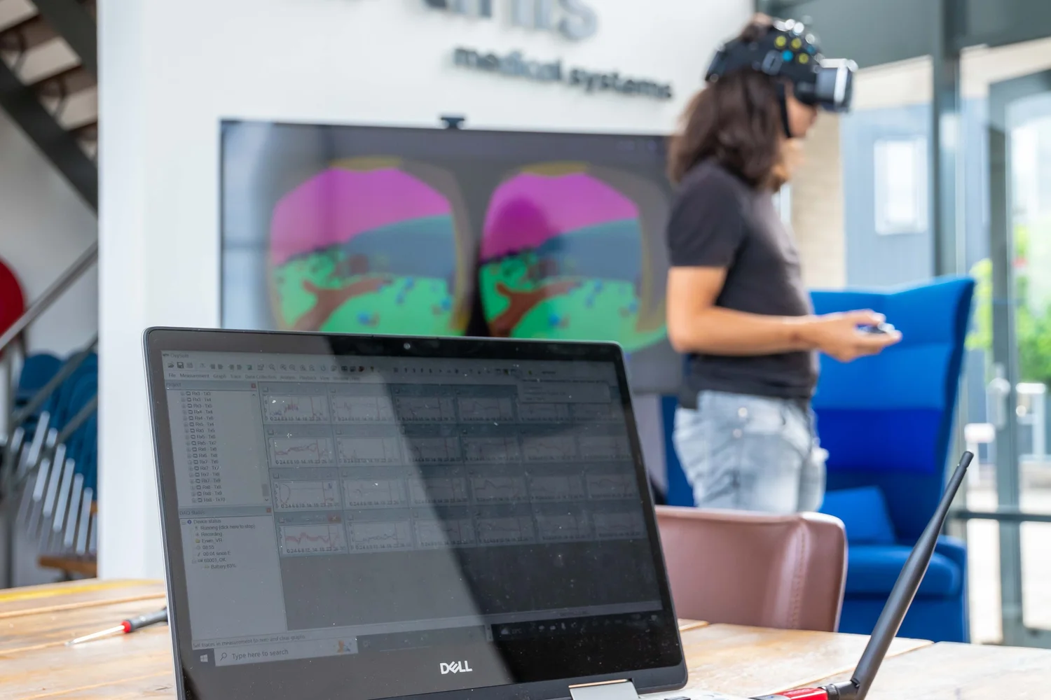 Publication Overview with our NIRS devices in 2022 – Brain - Artinis ...