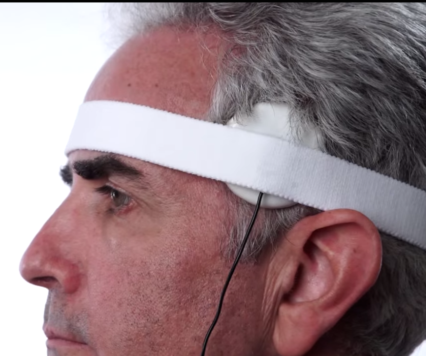 Electric Stim — BrainHope.com